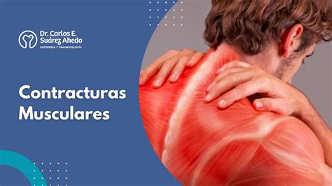 Cómo prevenir y tratar las contracturas musculares consejos de un