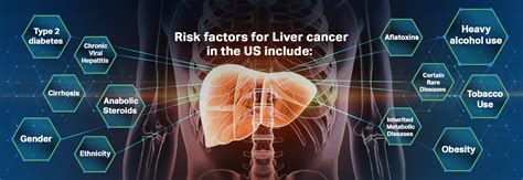 Stage 4 Hepatic Liver Cancer Treatment Envita Medical Center