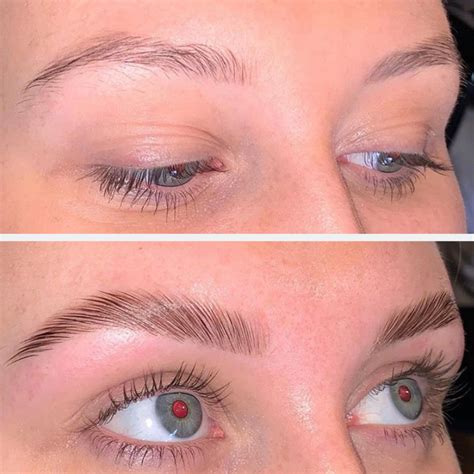 Pin On Before And Afters