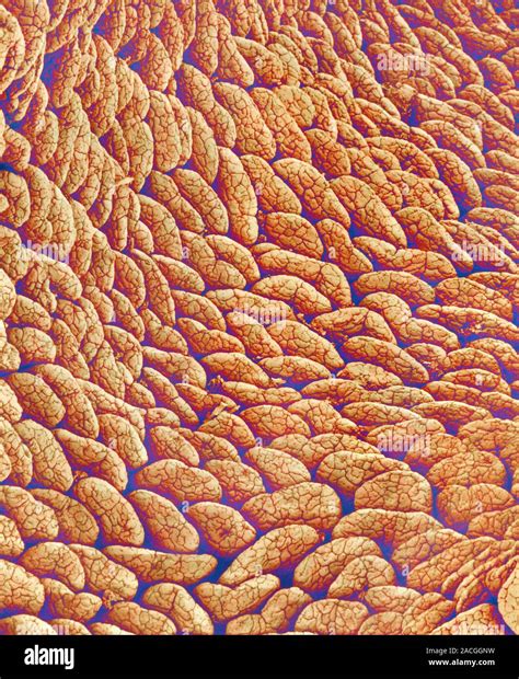 Intestinal Lining Coloured Scanning Electron Micrograph Sem Of Villi