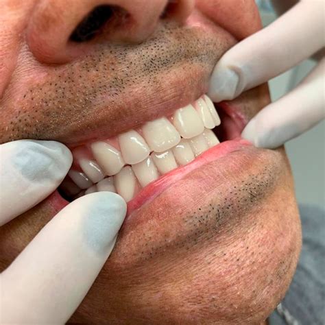 Implante Dentário Só Sorriso Odontologia Recreio do Bandeirantes