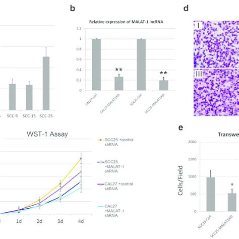 Knockdown Of MALAT 1 LncRNA Impaired Proliferation And Migration Of
