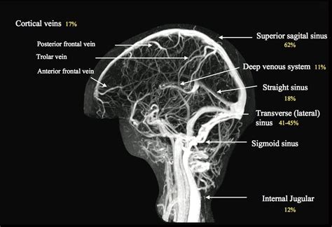 Neck Angio Mri Images Mapasgmaes