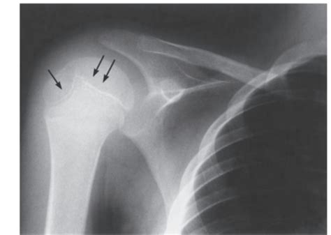Diagnostic Imaging Exam Upper Extremity Flashcards Quizlet