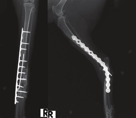 Craniocaudal And Mediolateral Postoperative Radiographs After Pantarsal