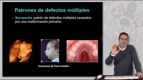 DEFECTOS Y ANOMALÍAS CONGÉNITAS YouTube