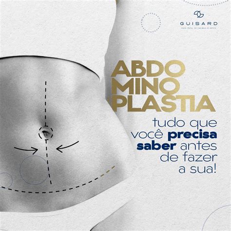 Abdominoplastia tudo que você precisa saber antes de fazer a sua Dr