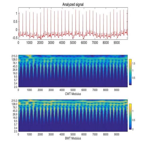 pdf a fast and simple adaptive bionic wavelet transform ecg baseline shift correction