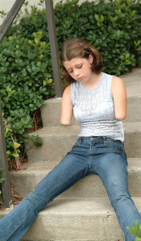 Amputee Girls Birth Defect Amputee Girls
