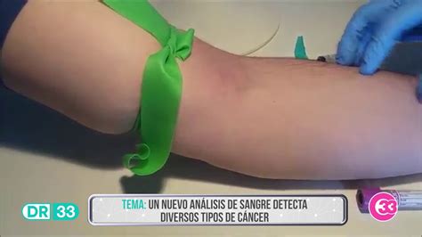 Un nuevo análisis de sangre detecta diversos tipos de cáncer YouTube