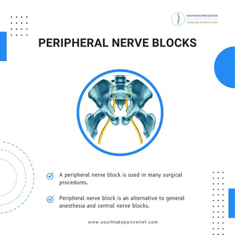 Types Of Anesthesia Nerve Blocks Infoupdate Org