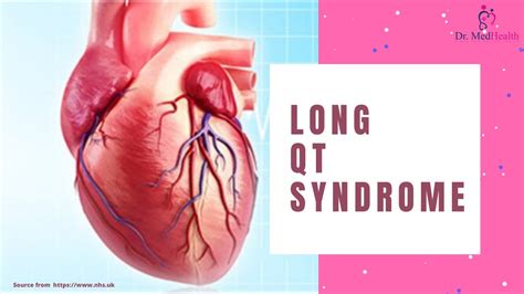 What Is Long Qt Syndrome Symptoms Risk Causes Diagnosis And