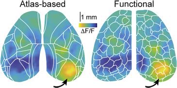 Mesoscopic Imaging Shining A Wide Light On Large Scale Neural Dynamics