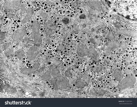 Transmission Electron Microscope Tem Micrograph Showing Stock Photo