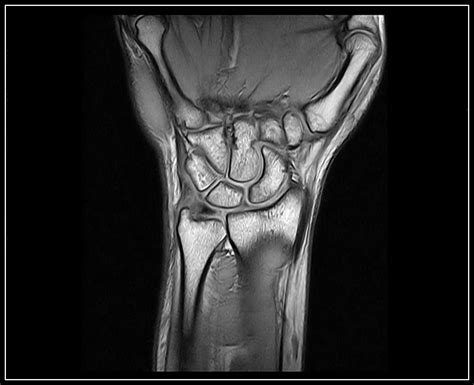 MRI Systems