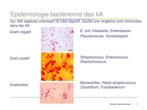 Ppt Infections Intra Abdominales Quelle Antibioth Rapie Powerpoint