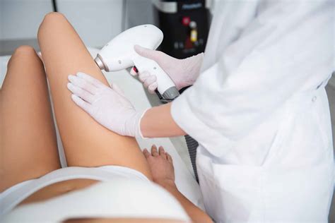 Lépilation laser pour les peaux noires est elle efficace