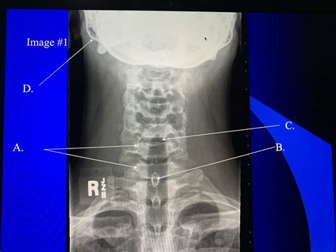Ap C Spine Diagram Quizlet