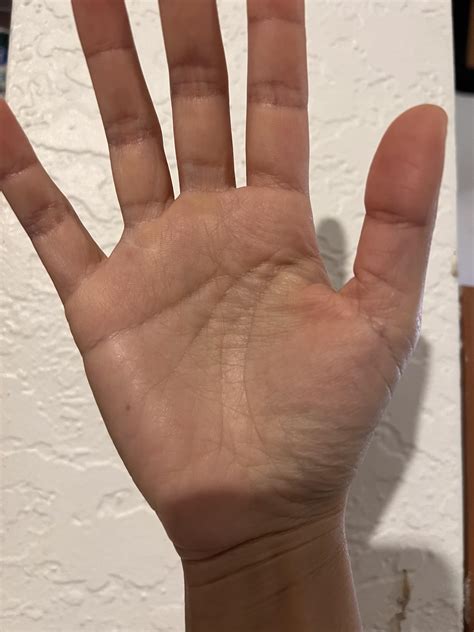Why Does My Lifeline Split Into Two R PalmReading