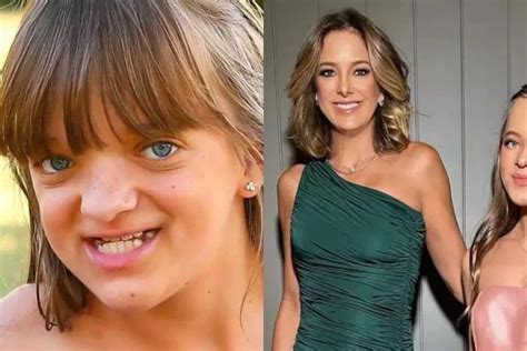 Após cirurgia plástica no rosto Rafaella Justus exibe o resultado ao