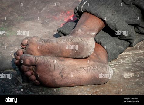Feet Soles Heels Telegraph