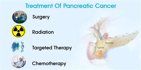 Main Symptoms Causes and Treatment of Pancreatic Cancer An Tâm