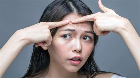 Penyebab Wajah Kusam Dan Berjerawat Beserta Solusinya KlikDokter