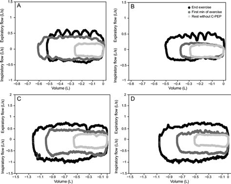 individual flow volume curves at rest without conical positive download scientific diagram
