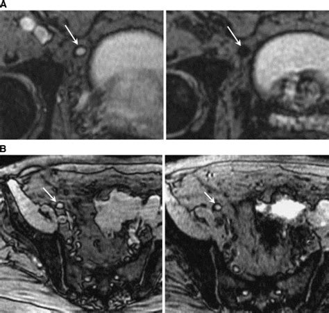 Prostate Cancer Imaging—what The Urologic Oncologist Needs To Know Radiologic Clinics
