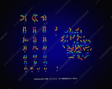 Male Karyotype Showing Down S Syndrome Stock Image C022 0565