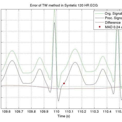 a 5 s segment of artificial ecg signal of 70 bpm generated by the download scientific diagram