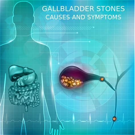 Gall Bladder Stone Symptoms