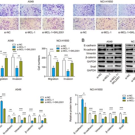 Wnt β catenin pathway mediated the role of MCL 1 in NSCLC cell