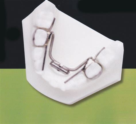 Slim Line Expander Dental Kögel KFO Online Shop
