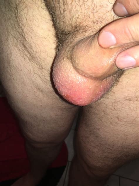 Saline Balls Pics Xhamster