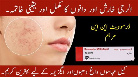 Dermovate Nn Ointment Review Benefits Of Dermovate Nn Ointment How