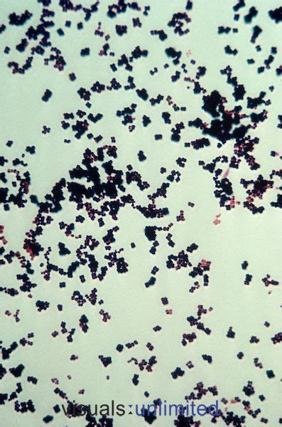 Rhizobium Bacteria Microscope