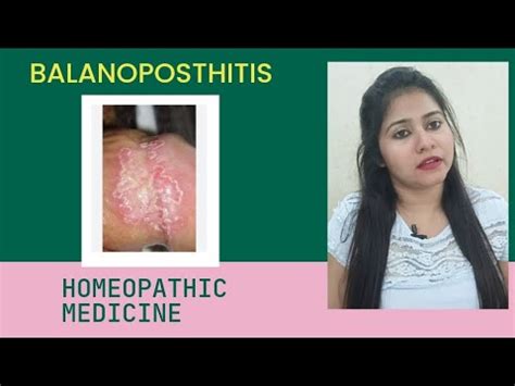 पनस हड म इनफकशन Balanoposthitis क करण लकषण और इलज