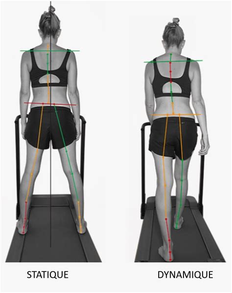 Bilan Postural Ops Analyse De La Posture En Statique Et En Dynamique