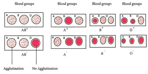 Blood Grouping Practical Experiment Microbiology
