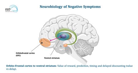 Negative Symptoms In Schizophrenia A Review Of Neurobiology