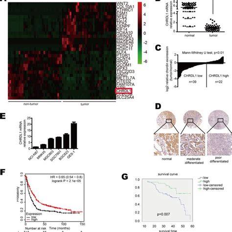 Low CHRDL1 Expression Activated Akt And Erk In Gastric Cancer A