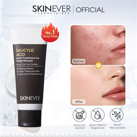 SKINEVER Salicylic Acid Pimple Remover Acne Treatment Ice Sleep Masque