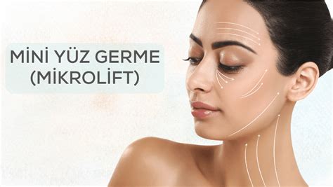 Mini Yüz Germe Mikrolift Fiyat Op Dr Elif Seda Keskin
