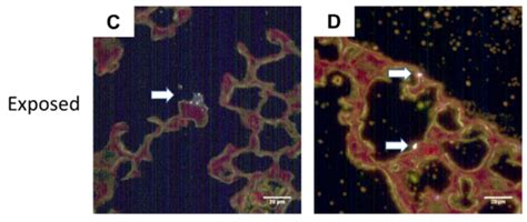 Microplastics Absorbed By Fetus Persist After Birth Study In Mice