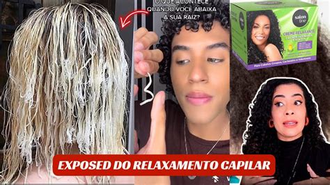 EXPOSED DA SOLTURA DOS CACHOS RELAXAMENTO CASEIRO ESTRAGA O CABELO