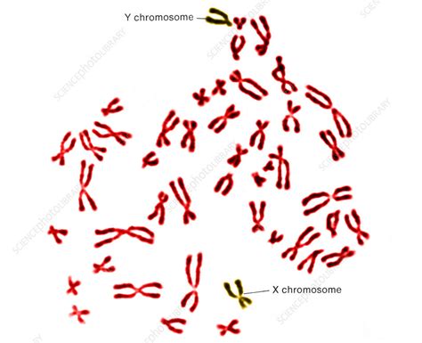 Male Karyotype Stock Image C022 0508 Science Photo Library