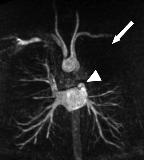 Applications Of Time Resolved MR Angiography AJR