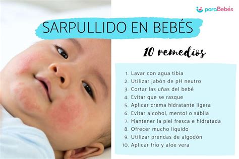 SARPULLIDO en BEBÉS 16 Tipos causas y tratamiento