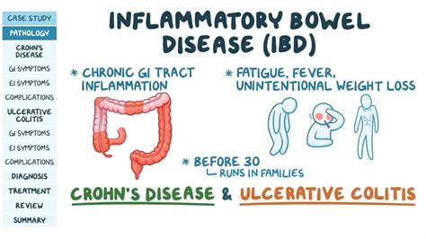Inflammatory Bowel Disease Pathology Review Video Osmosis